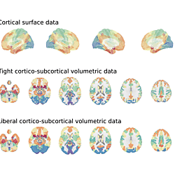 Item - CAB-NP projected on MNI2009a GM (volumetric) in NIfTI format ...