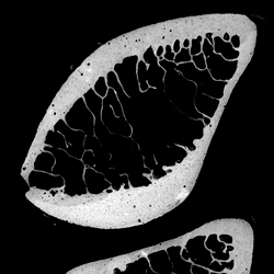 Micro-radiograph of Rib #05