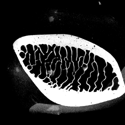 Micro-radiograph of Rib #10