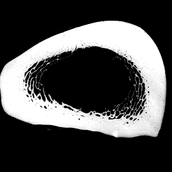 Micro-radiograph of Tibia #03