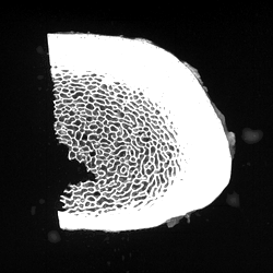 Micro-radiograph of Metacarpal Metaphysis #01