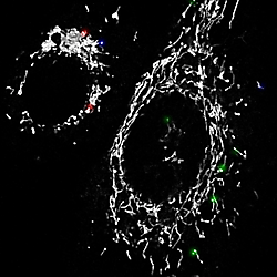 Dirty Dataset Events On Mitochondrial Strands Training Set