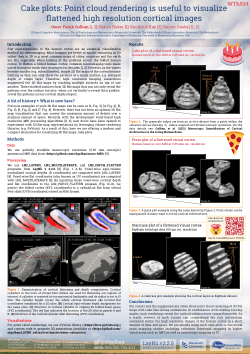 Cake plots: Point cloud rendering is useful to visualize flattened high ...