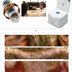 Rapid reading software by CapsoVision
