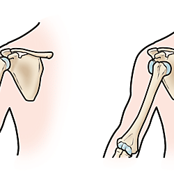 Shoulder Dislocation Surgery