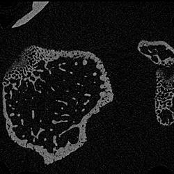 remaining mouse CT scans (tibial epiphysis)