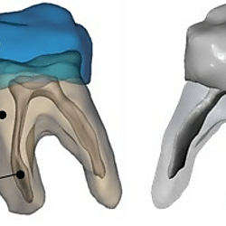 Biomodel of the lower right first molar
