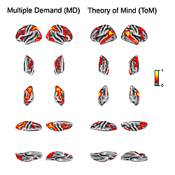 Item - Lipkin et al. (2022) Online Supplement: Probabilistic atlases ...