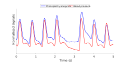 A comparison of blood pressure and photoplethysmogram signals