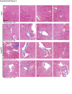 Supplemental Figure 2. Histological scoring chart for kidney fibrosis.