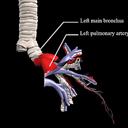 Anatomic relationship between the left main bronchus and the left ...