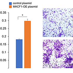 Cell Motility Bar Graph and Images