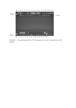 Gel electrophoresis image of HEV PCR amplicon product with 137 bp ORF2/ORF3