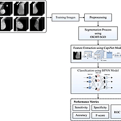 Deep Learning Based Capsule Neural Network Model for Breast Cancer ...