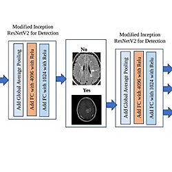 Brain Tumor Detection and Classification Using Cycle Generative Adversarial Networks