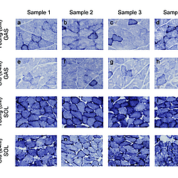 Succinate dehydrogenase (SDH) staining