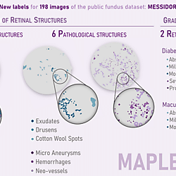 MAPLES-DR: MESSIDOR Anatomical and Pathological Labels for Explainable ...