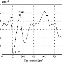 Normal subject VEP waveform