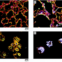Dark field micrographs of lung tissue with H&E staining () and alveolar ...