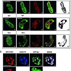 CTIP2 colocalizes with Sp1 and COUP-TF within Hp1α-associated structures