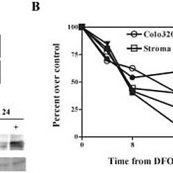 Hypoxia-suppressed CAD expression can be mimicked by DFO treatment