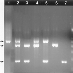 Differential detection of , and by nested multiplex PCR on stool samples