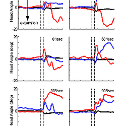 Angular excursion of the head in space for 2 sec before and 2 sec after ...