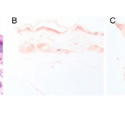 Peri-incisional infiltration of neutrophils, immunohistochemical appearance