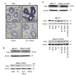 (A) Immunohistochemistry of Bcl-2 staining (brown to dark) in ERα ...