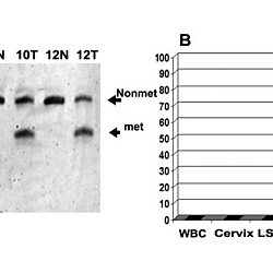 Schematic representation of methylation-specific PCR in CC