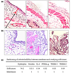 Histologic and molecular characterization of dissected membranes and ...