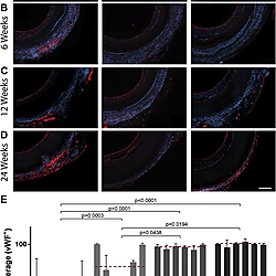 Figure 5: Immunohistologic Staining for vWF