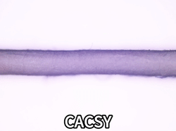 Rational Design of a Hydrophilic Core–Hydrophobic Shell Yarn-Based ...