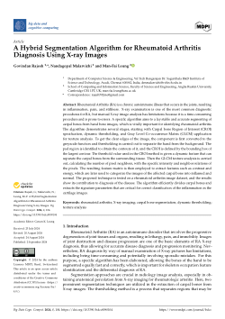 A Hybrid Segmentation Algorithm for Rheumatoid Arthritis Diagnosis Using X-ray Images