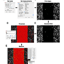 Image_1_In vitro Cell Migration, Invasion, and Adhesion Assays: From ...
