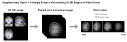 Image_1_Identifying Schizophrenia Using Structural MRI With a Deep Learning Algorithm.pdf