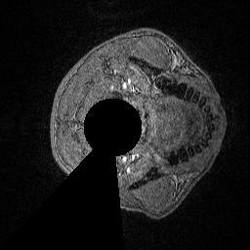 Video_2_Identifying Schizophrenia Using Structural MRI With a Deep Learning Algorithm.avi