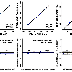 Image_1_Partitioning the Right Ventricle Into 15 Segments and ...