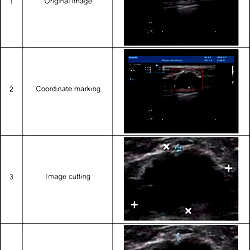 Image_2_Evaluating the Accuracy of Breast Cancer and Molecular Subtype ...