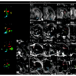 Image_8_On the Embryonic Development of the Nasal Turbinals and Their ...