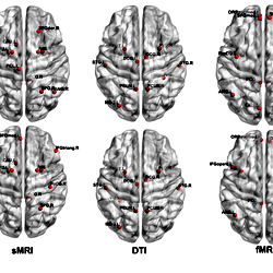 Image_3_Morphological, Structural, and Functional Networks Highlight ...