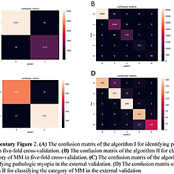 Image_2_AI-Model for Identifying Pathologic Myopia Based on Deep Learning Algorithms of Myopic ...