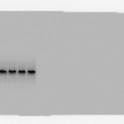 Image_2_Mutations in FIGLA Associated With Premature Ovarian ...