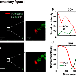 Image_1_Efficient and Accurate Synapse Detection With Selective Structured Illumination ...