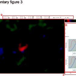 Image_3_Efficient and Accurate Synapse Detection With Selective Structured Illumination ...