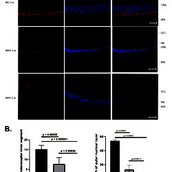 Image2_Retinal Development and Pathophysiology in Kcnj13 Knockout Mice.tif