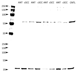Image_2_Complement Factor H in cSCC: Evidence of a Link Between Sun ...