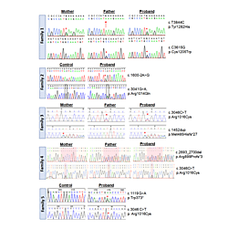 Image1_Autosomal Recessive Cerebellar Atrophy and Spastic Ataxia in Patients With Pathogenic ...