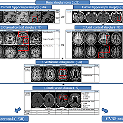 Image_1_Predicting progression to dementia with “comprehensive visual rating scale” and machine ...