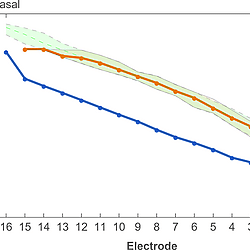 Image_1_Imaging-based frequency mapping for cochlear implants ...